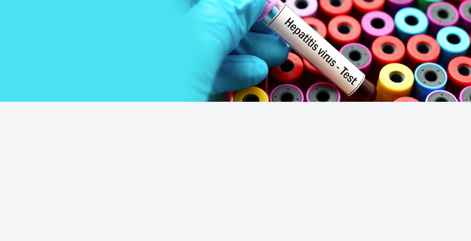 Screening auf Hepatitis B und C | Labordiagnostik